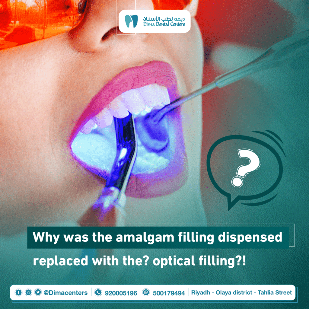 Amalgam Filling - Dima Dental Center